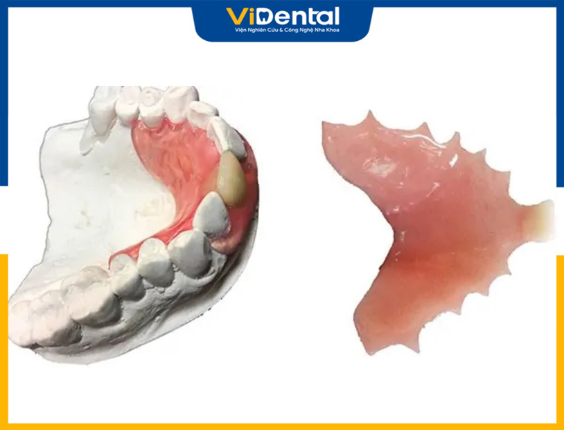 Hàm Tháo Lắp 1 Răng: Đặc Điểm, Phân Loại Và Mức Giá